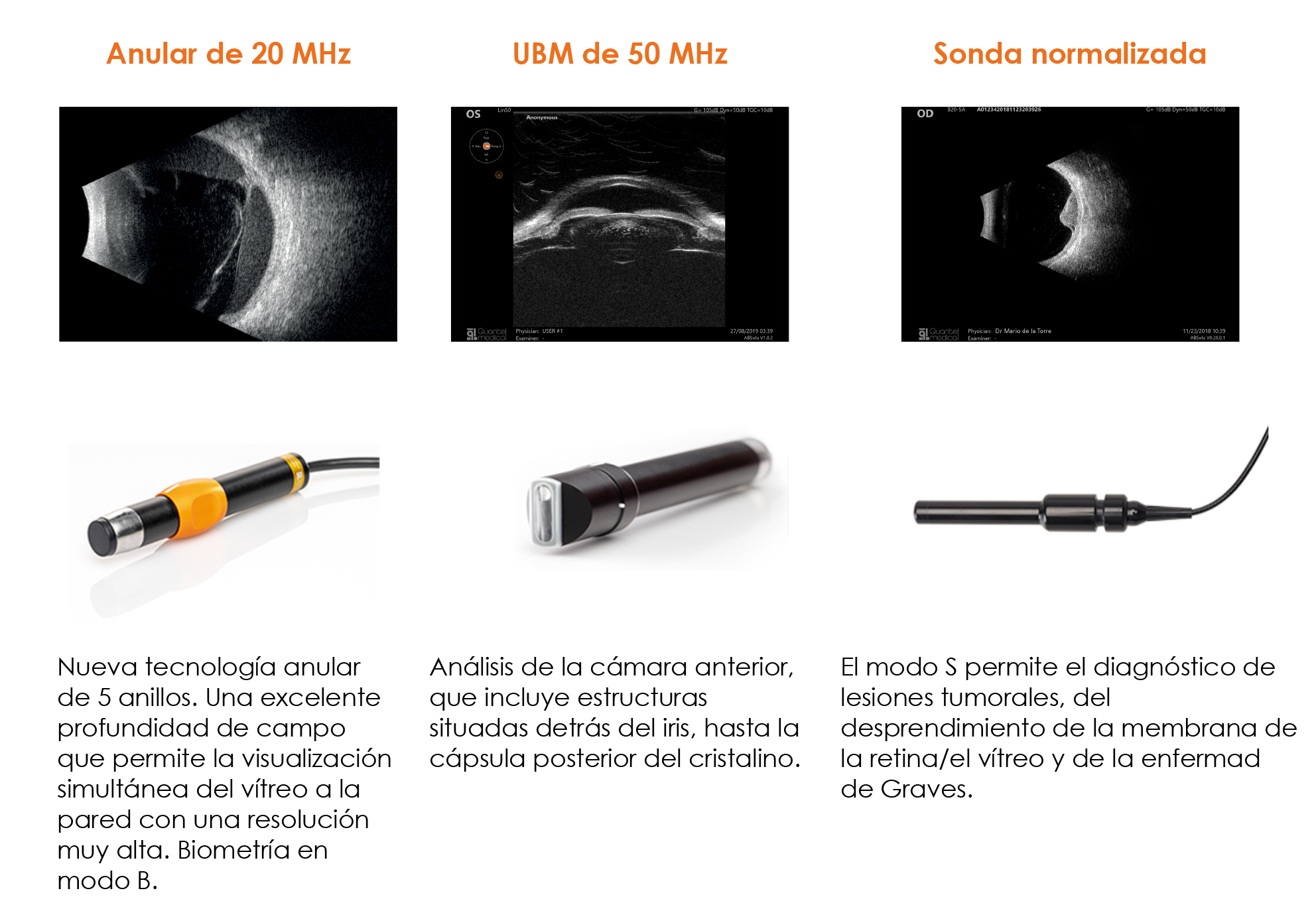ABSolu – Plataforma de Ultrasonidos A/B/S/UBM – Quantel Medical by ...