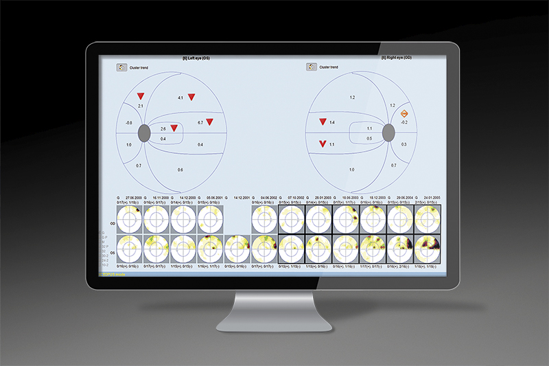 OCTOPUS 900® – Perímetro – Haag Streit Diagnostics – Amv Tecnologia C.A.