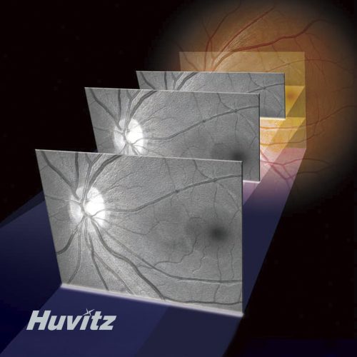 HOCT-1/1F – Tomógrafo de Coherencia Óptica – Huvitz – Amv Tecnologia C.A.