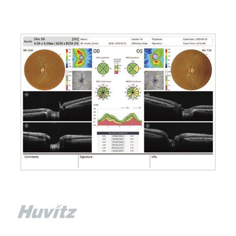 HOCT-1/1F – Tomógrafo de Coherencia Óptica – Huvitz – Amv Tecnologia C.A.